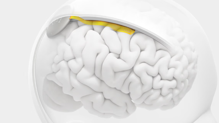 Neuralink Rival Precision Neuroscience’s Minimally Invasive Layer 7 ...